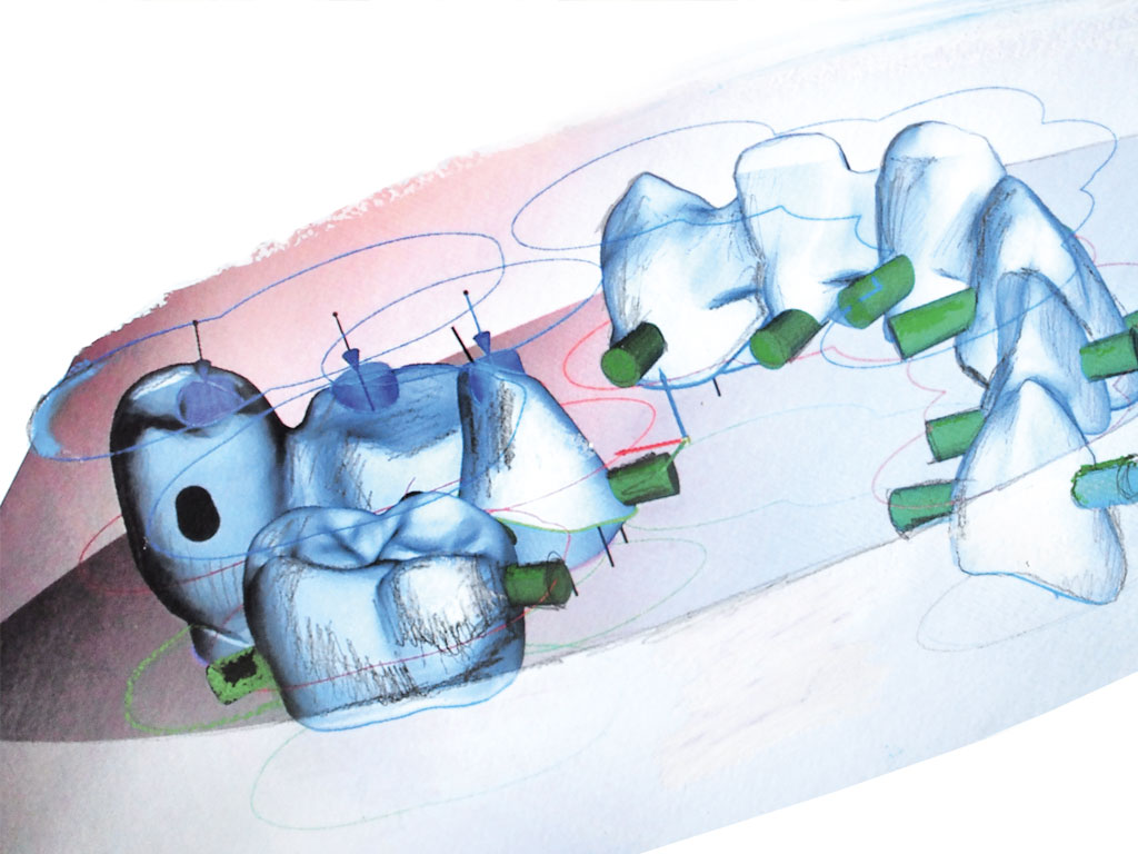 hyperDENT V8 is now available! - FOLLOW-ME! Technology Group