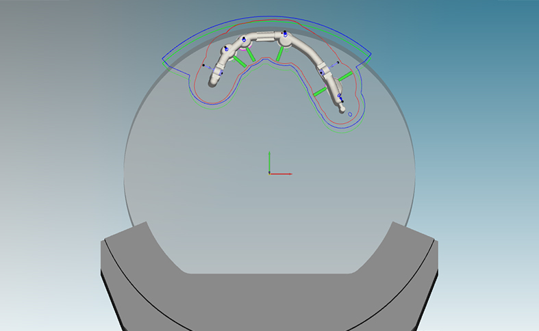 hyperDENT - FOLLOW-ME! Technology Group