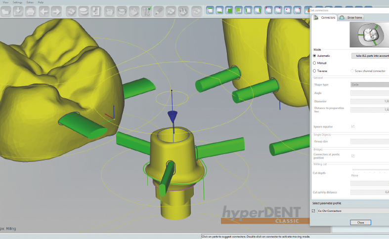 Hyper Dent Function Overview – Unique Dental Supply Inc.
