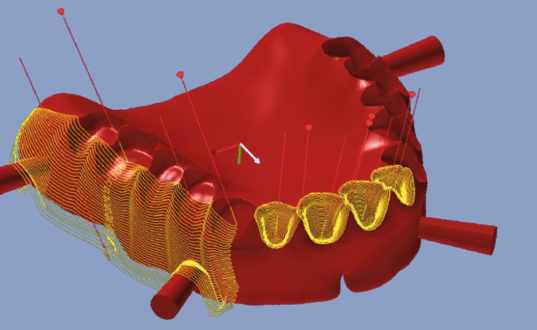 hyperDENT - FOLLOW-ME! Technology Group