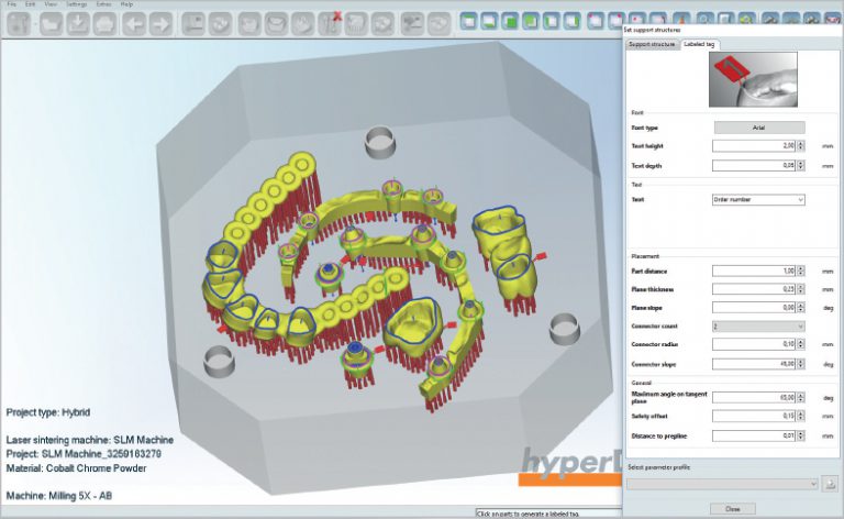hyperDENT - FOLLOW-ME! Technology Group