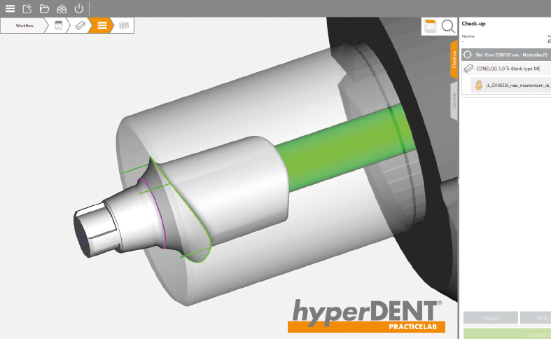 Hyper Dent Function Overview – Unique Dental Supply Inc.