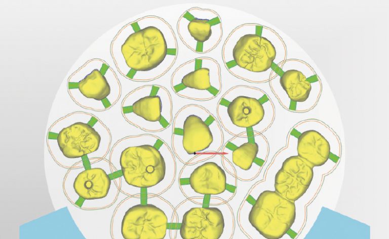 hyperDENT Cam Softwares - Botelli