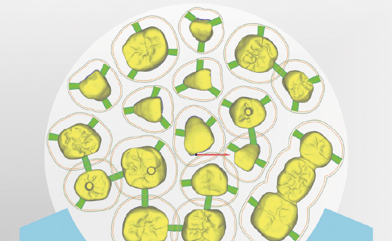 hyperDENT OLD - FOLLOW-ME! Technology Group