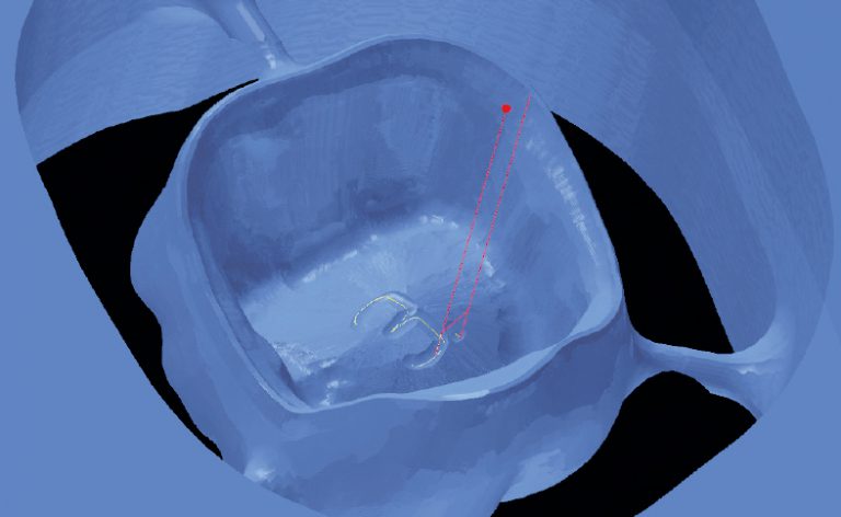 hyperDENT - FOLLOW-ME! Technology Group