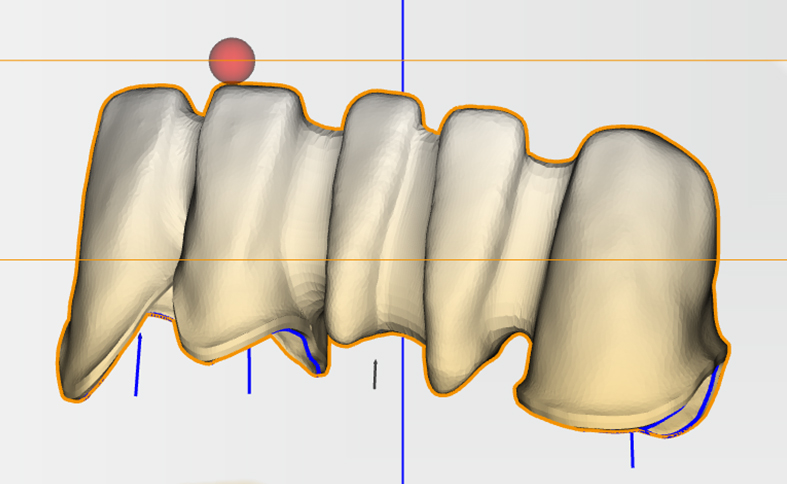 hyperDENT - FOLLOW-ME! Technology Group