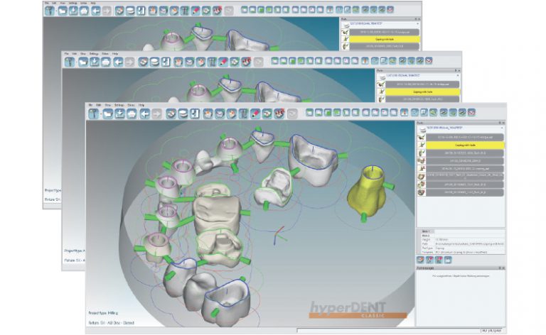 hyperDENT - FOLLOW-ME! Technology Group