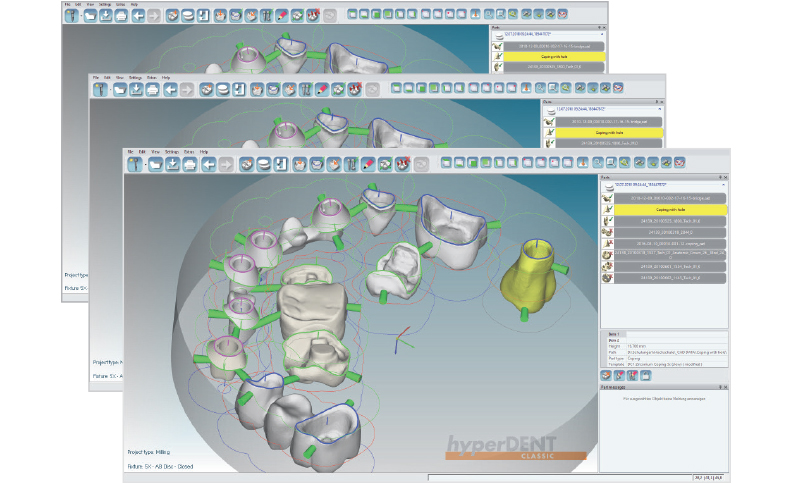 hyperDENT OLD - FOLLOW-ME! Technology Group