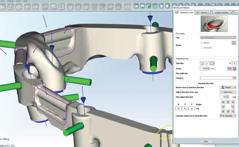 hyperDENT - FOLLOW-ME! Technology Group