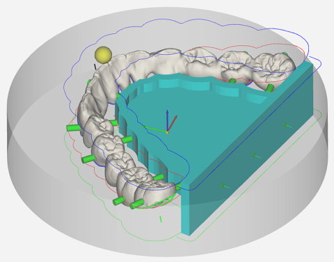 hyperDENT® V9.1 Release Highlights - FOLLOW-ME! Technology Group