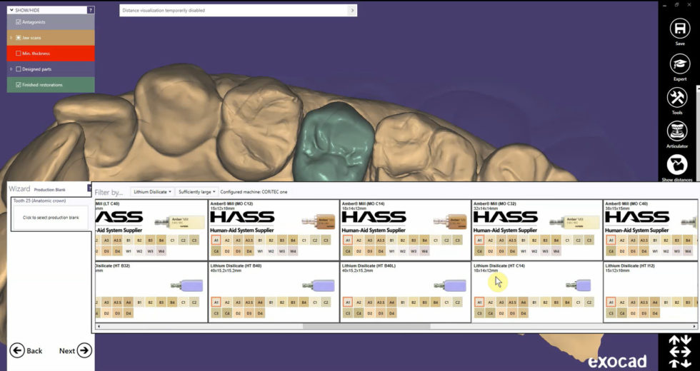 hyperDENT® V9.1 Release Highlights - FOLLOW-ME! Technology Group