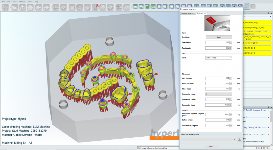 hyperDENT® Version 8.2 is now available - FOLLOW-ME! Technology Group