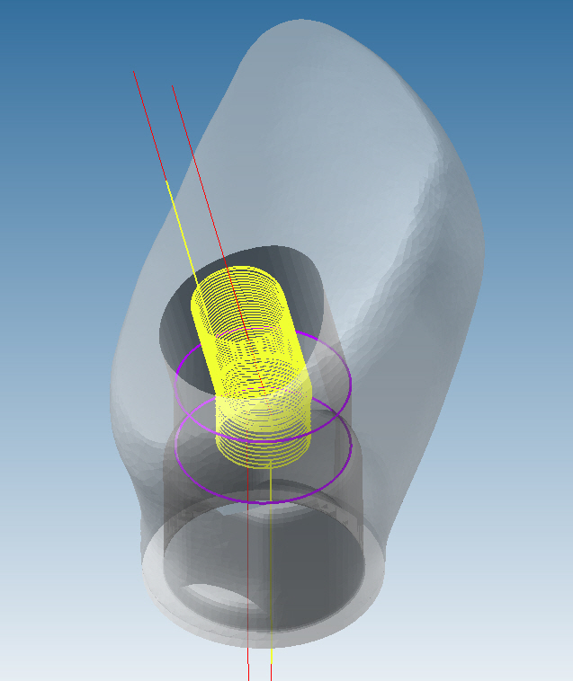 Angulated Screw Channel Module released - FOLLOW-ME! Technology Group